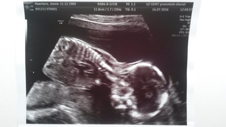 6e echo – Gent – Tweeling